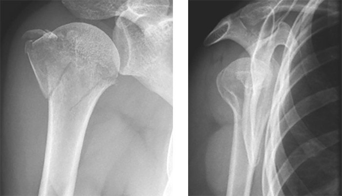 Sinnvolle Bildgebung bei Schulter- und Ellbogenverletzungen ...