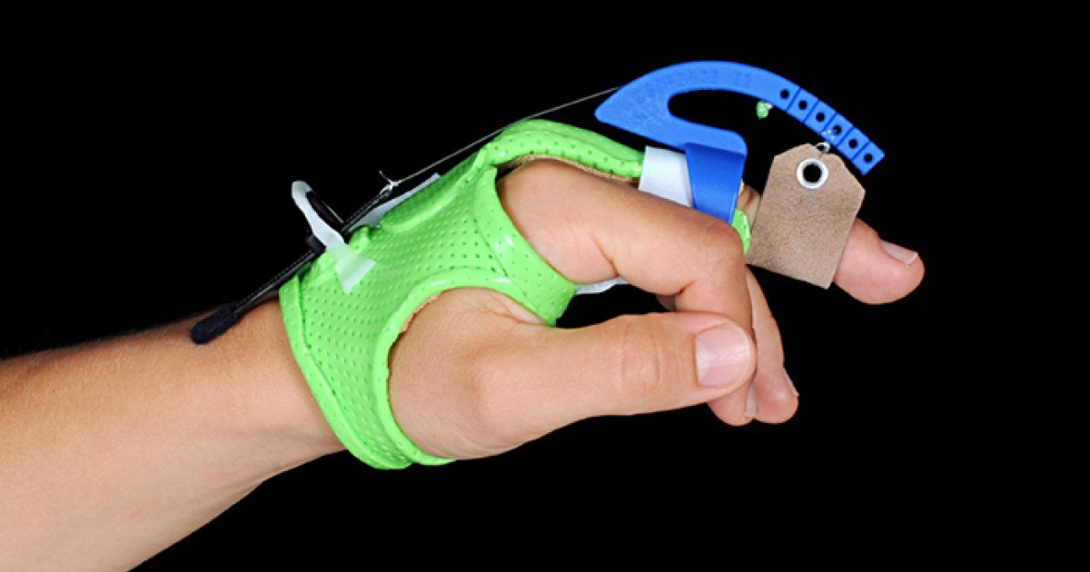 Isoforce hand splint outrigger launches internationally | Schulthess Klinik
