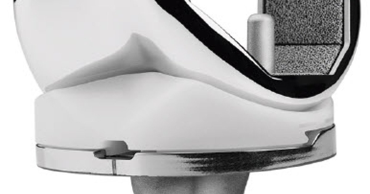 Knieprothese – Das künstliche Kniegelenk | Schulthess Klinik